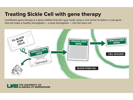 New gene therapy could provide cure for sickle cell disease